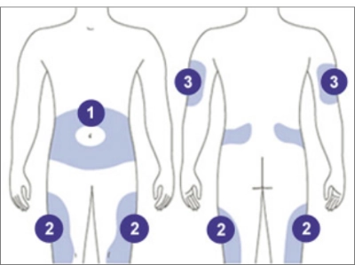 Can you inject insulin anywhere on your body? Or Must it be at the ...