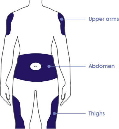 How to Use Lantus® Solostar® Pen | Injecting Lantus (insulin glargine ...